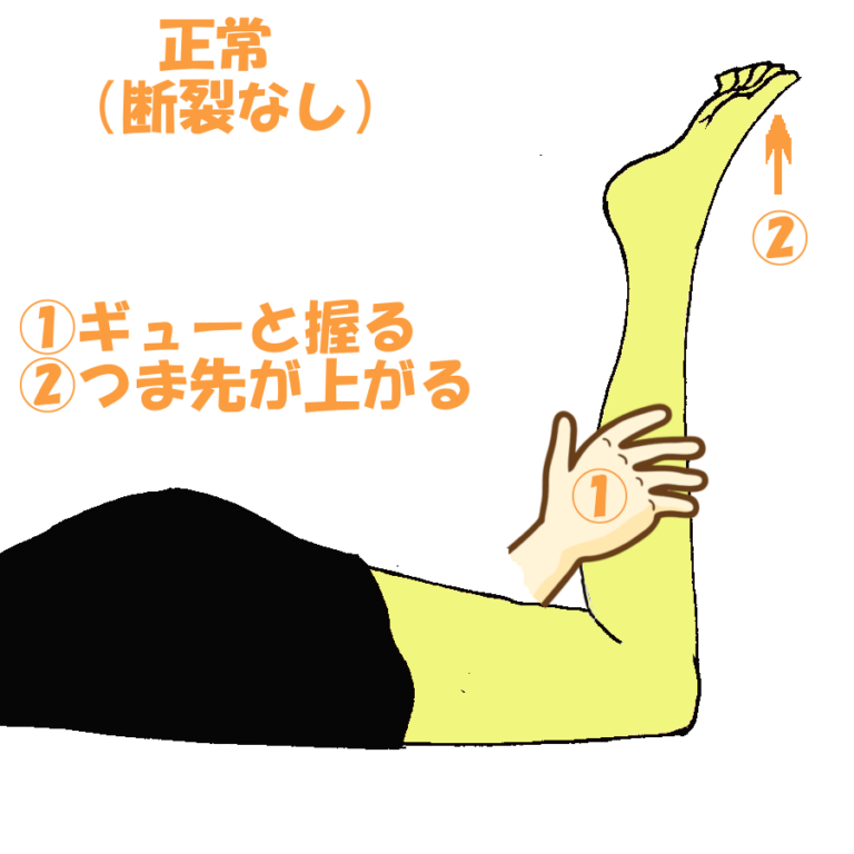 かんたんーアキレス腱断裂 - いい医者.com